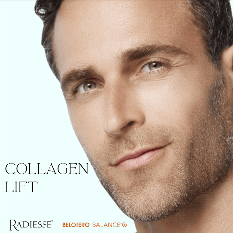 Collagen Lift | Skin Perfect Brothers Powered by VLA