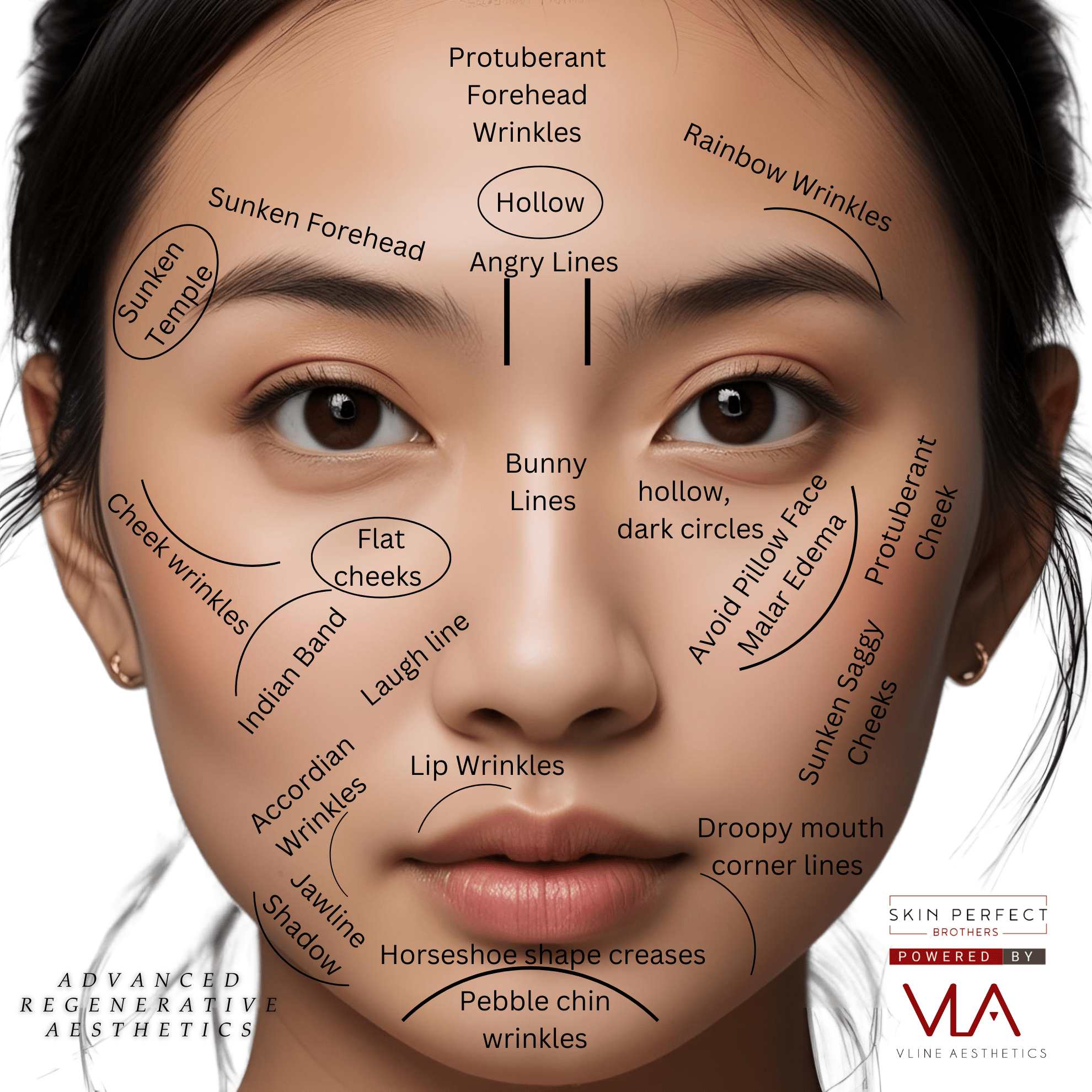 Skin Perfect Brothers Services– Skin Perfect Brothers Powered by VLA